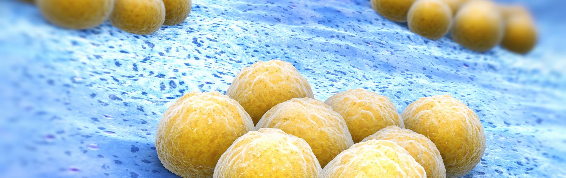 Unveiling a Resistance Mechanism in Staphylococcus Aureus - Cité des ...